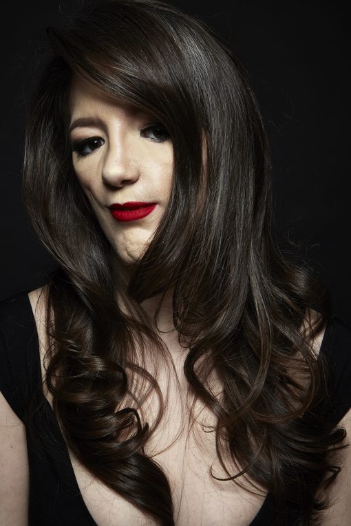 Different is Beautiful: an Interview with Alison Midstokke | Inspiring ...